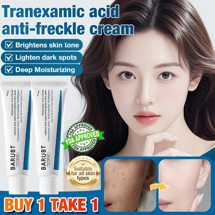 Tranexamic Acid Cream – Beautykomi