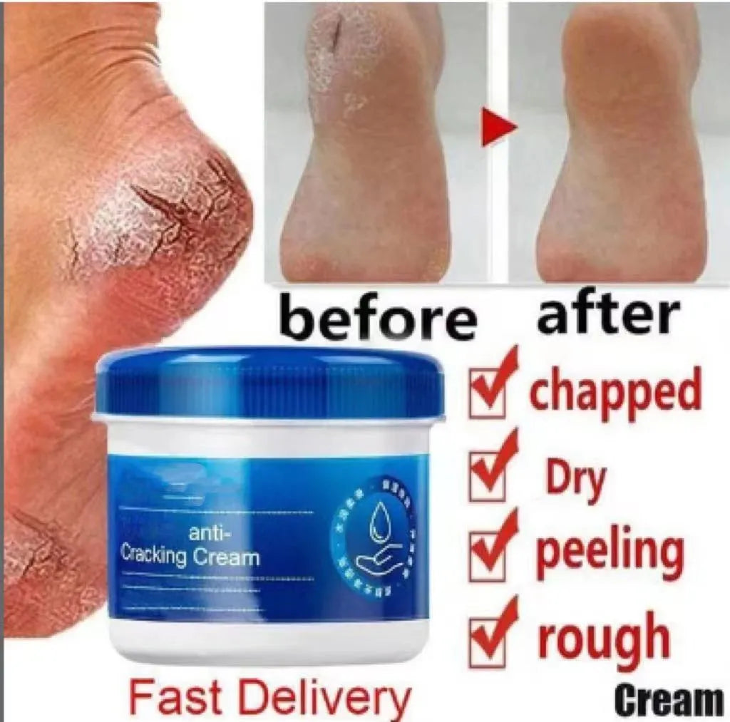 Foot Cream Anti-cracking Moisturizing Foot and Hand Cream Beauty 🔥BUY ...