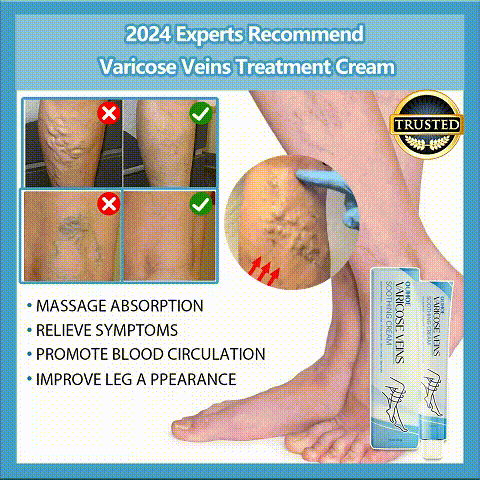 💥2024 Experts Recommend Product-Varicose Veins Treatment Cream – Beautykomi
