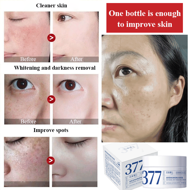 Build Milk Skin】 Dr. Houmei 377 Whitening freckle removal Cream ...
