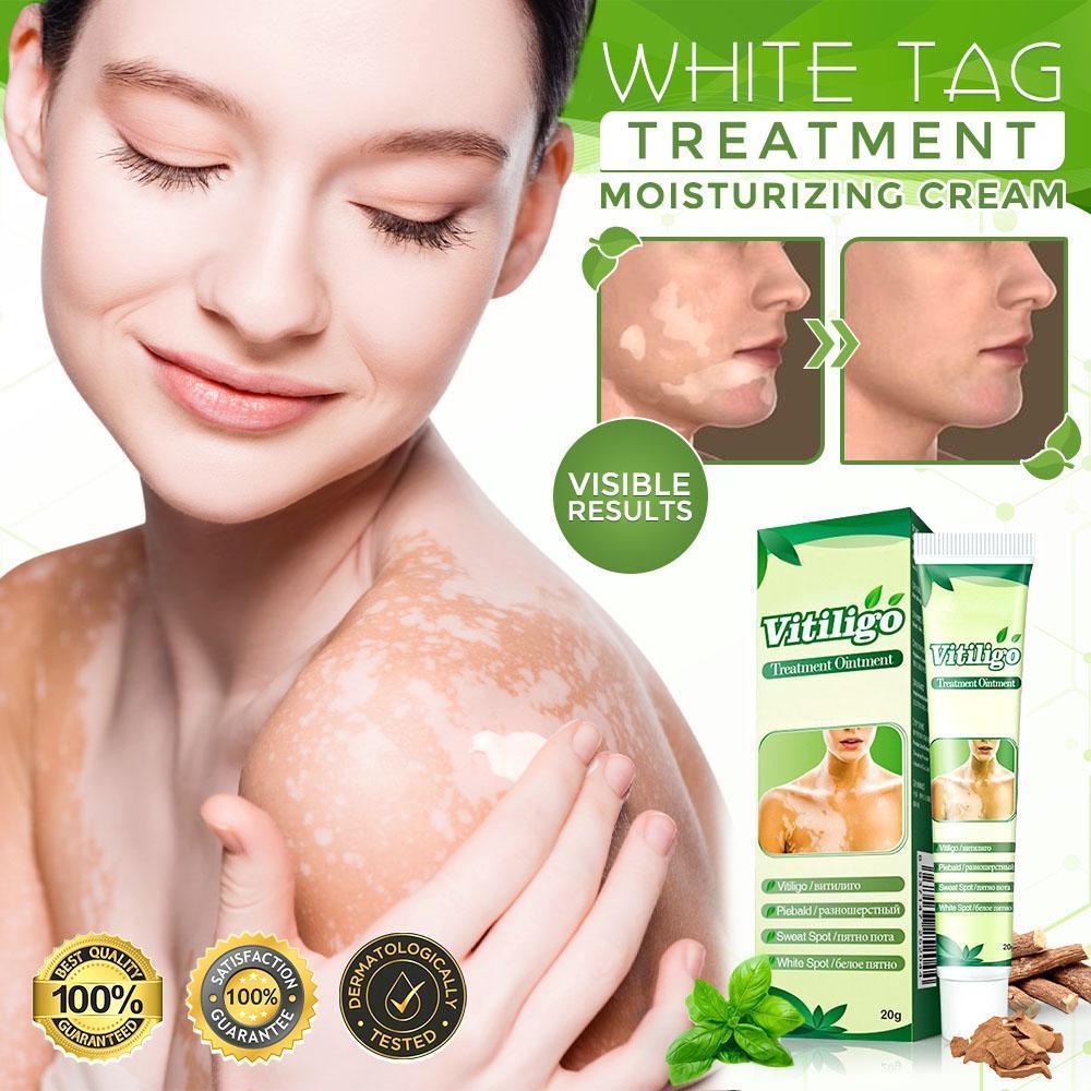 White Tag Treatment Moisturizing Cream – Beautykomi